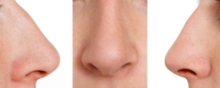 Which Nose Types Are Most Suitable For Your Face Shape?
